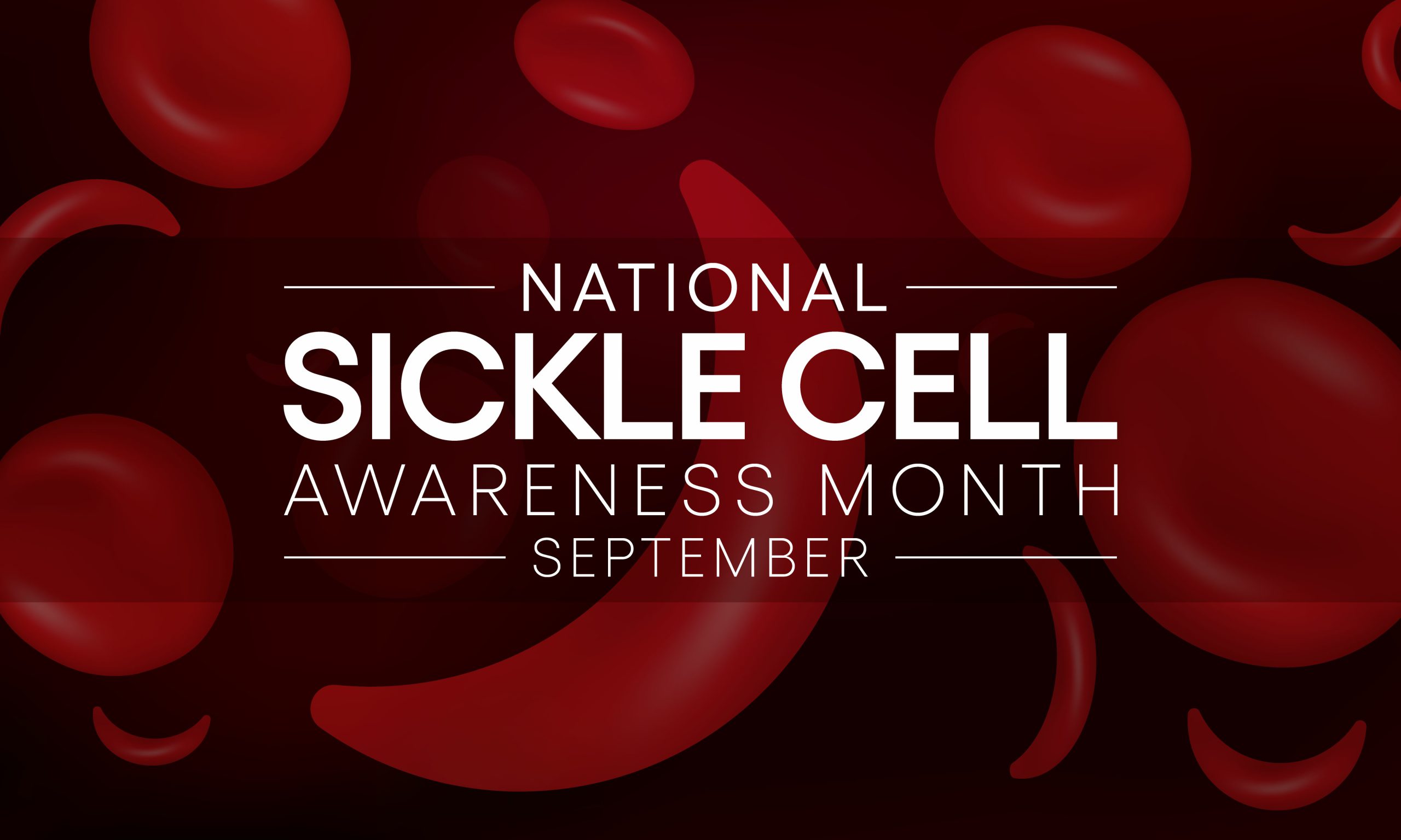 Stem cell gene therapy shows good results for sickle cell - The ...